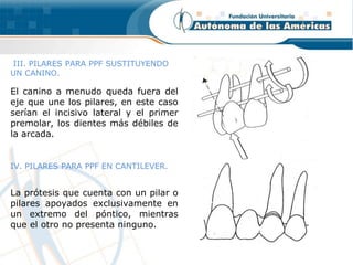 Pilares y ponticos | PPTX