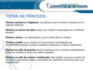 Pilares y ponticos | PPTX
