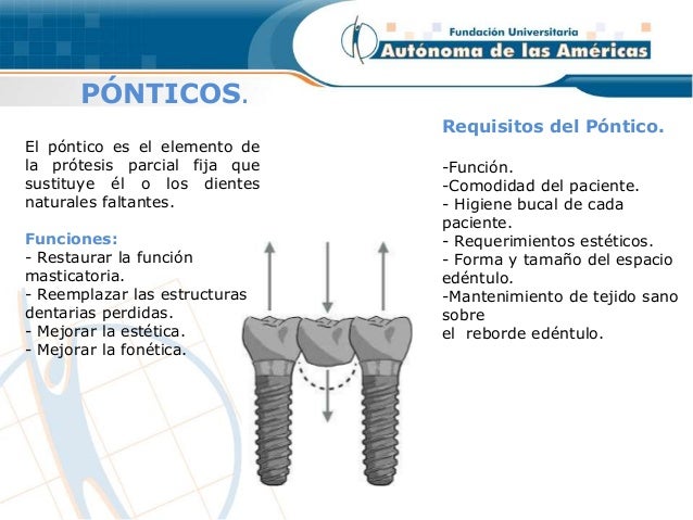 Pilares y ponticos