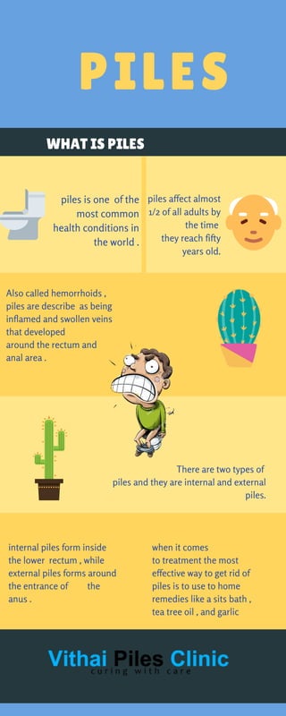 Piles | PDF