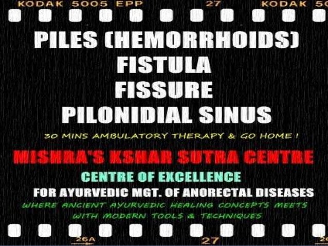 Piles Fistula In Ano Kshar Sutra Therapy Treatment Mishras Kshar