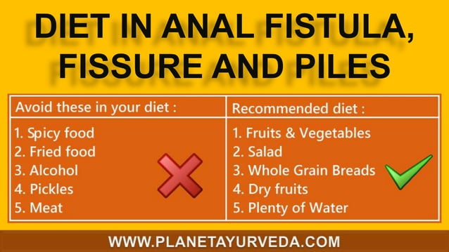 Piles Fissure-Fistula - Diet And Natural Treatment | PPT