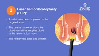 Piles Types, Causes and Symptoms | Piles Laser Treatment in Hyderabad | PPT