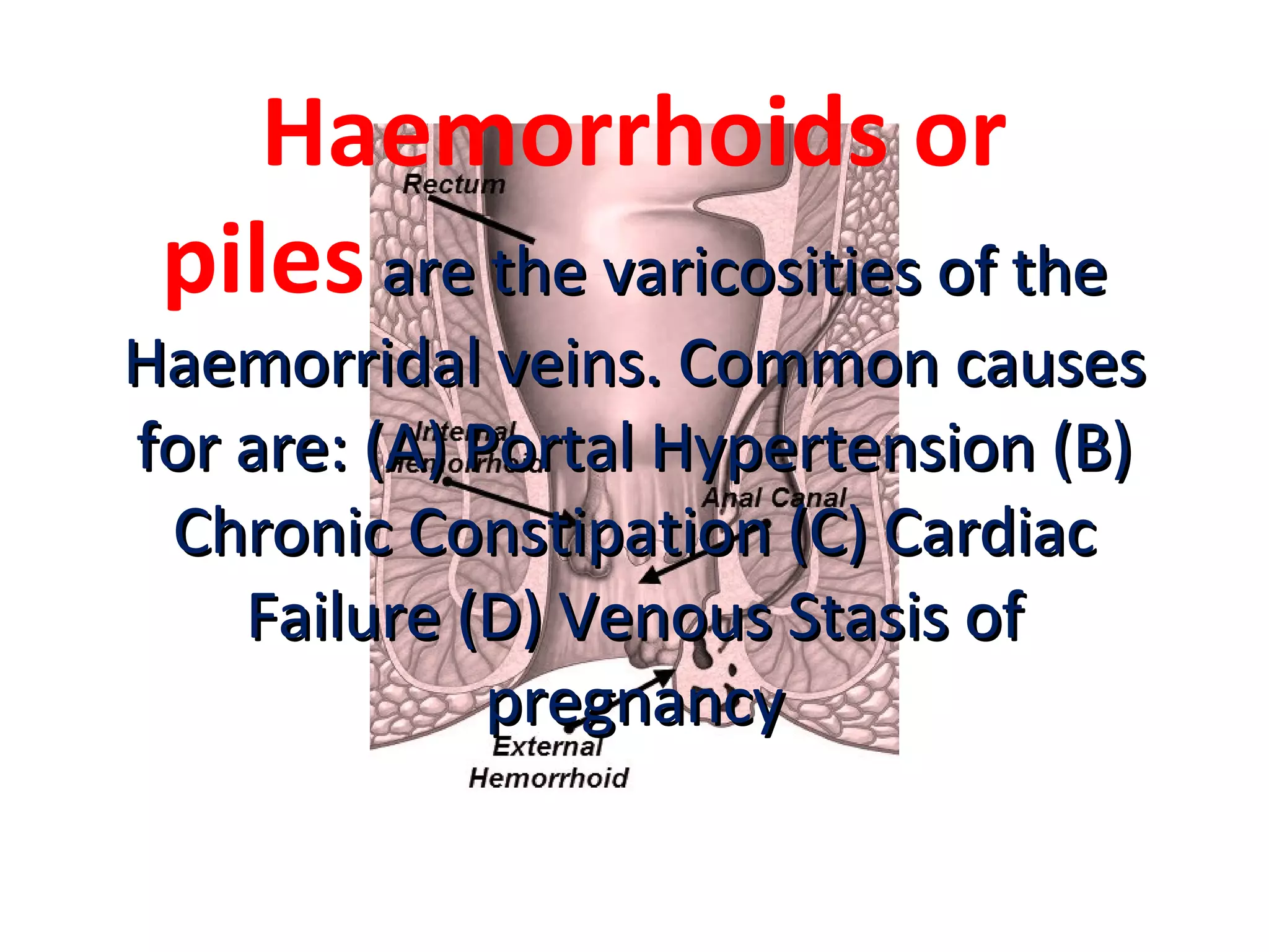 Piles fissures fistula | PPT