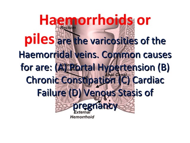 Piles fissures fistula | PPT