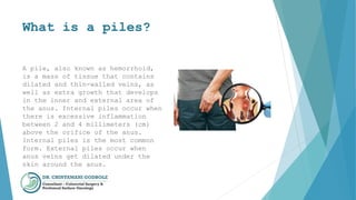 Piles (Hemorrhoids) | Dr. Chintamani Godbole | Colorectal Surgeon | PPT