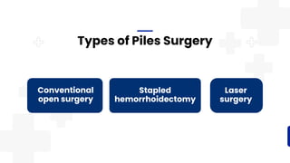 Trustworthy Piles Surgery by Dr. Gautam Nadkarni - Expertise and ...