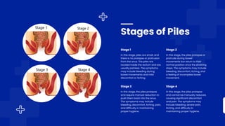 Trustworthy Piles Surgery by Dr. Gautam Nadkarni - Expertise and ...