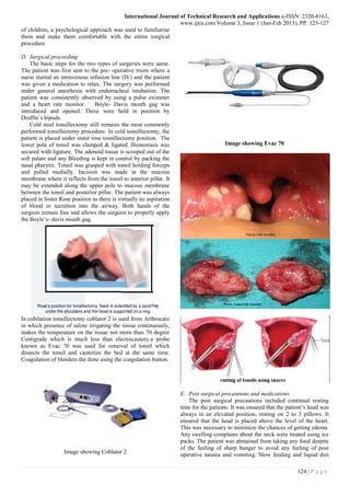 COMPARISON OF COLD TONSILECTOMY AND COBILATION TONSILECTOMY | PDF