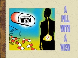 Pill camera | PPT