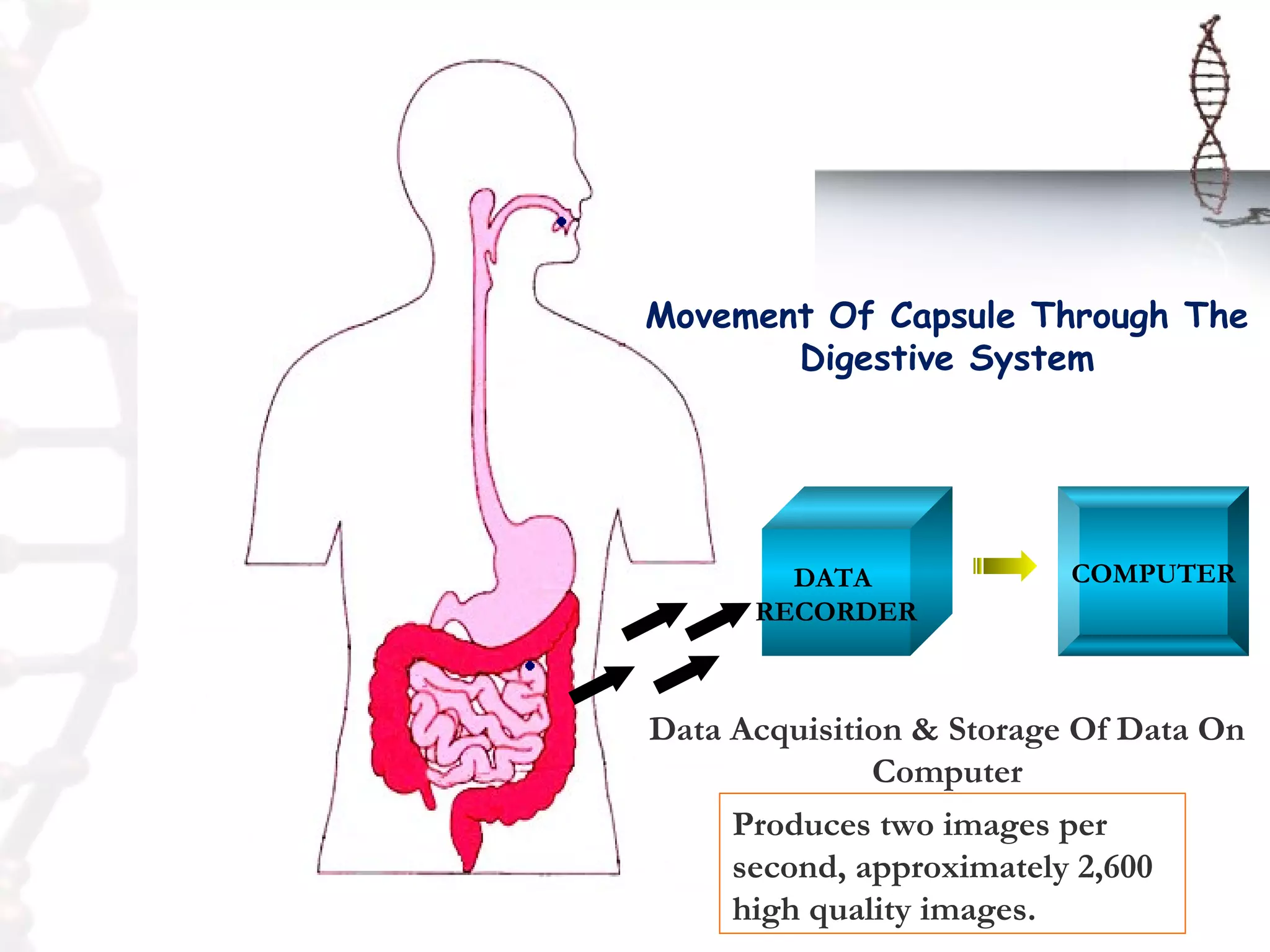 Pill camera presentation | PPT