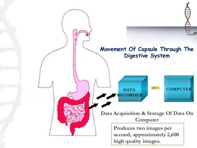 Pill camera presentation