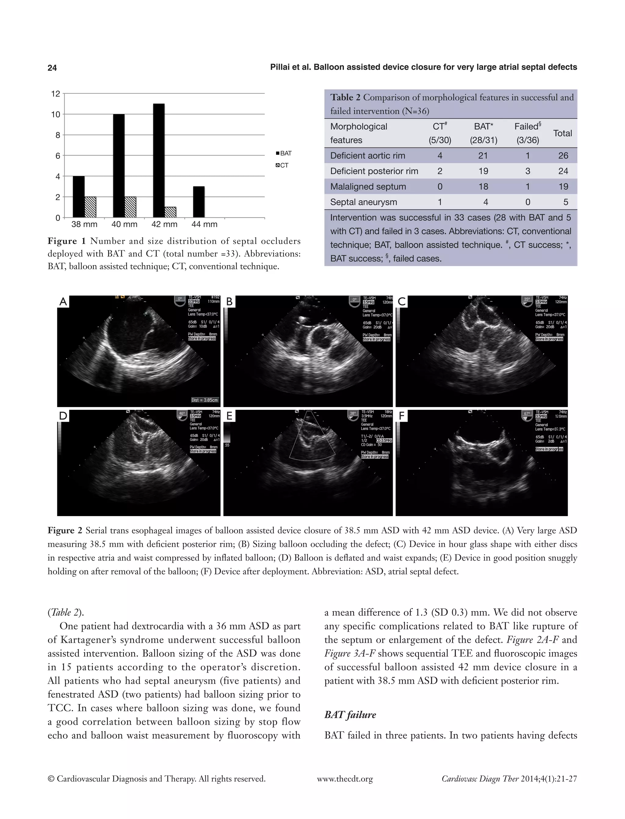 Utility of balloon assisted technique in trans catheter closure of very ...