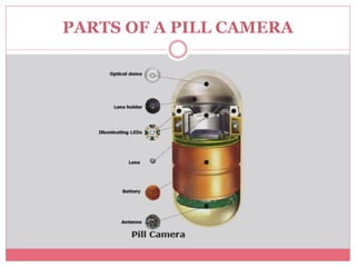 Pill cam | PPTX