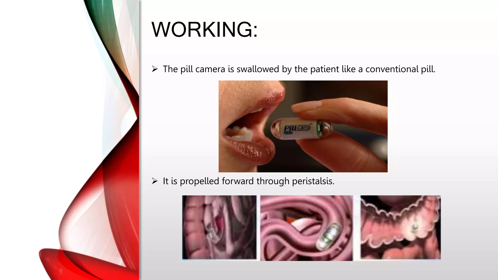 pill cam.pptx