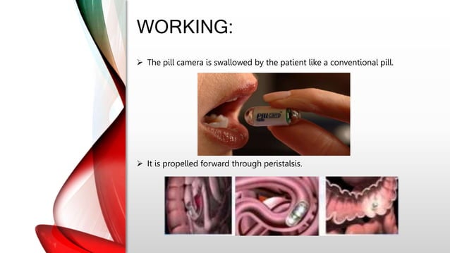 pill cam.pptx