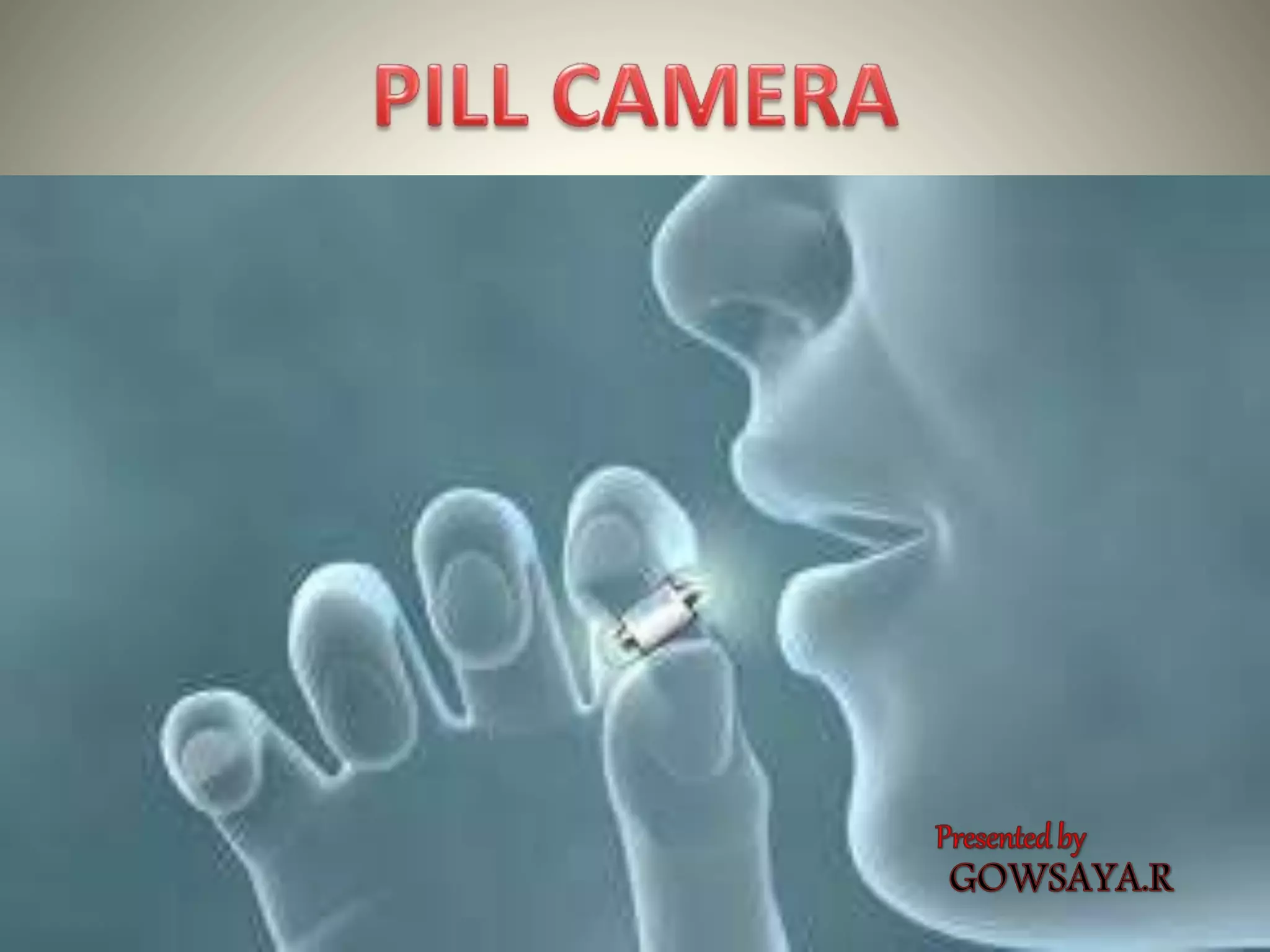 Pill cam 2 | PPTX | Digestive Disorders | Diseases and Conditions