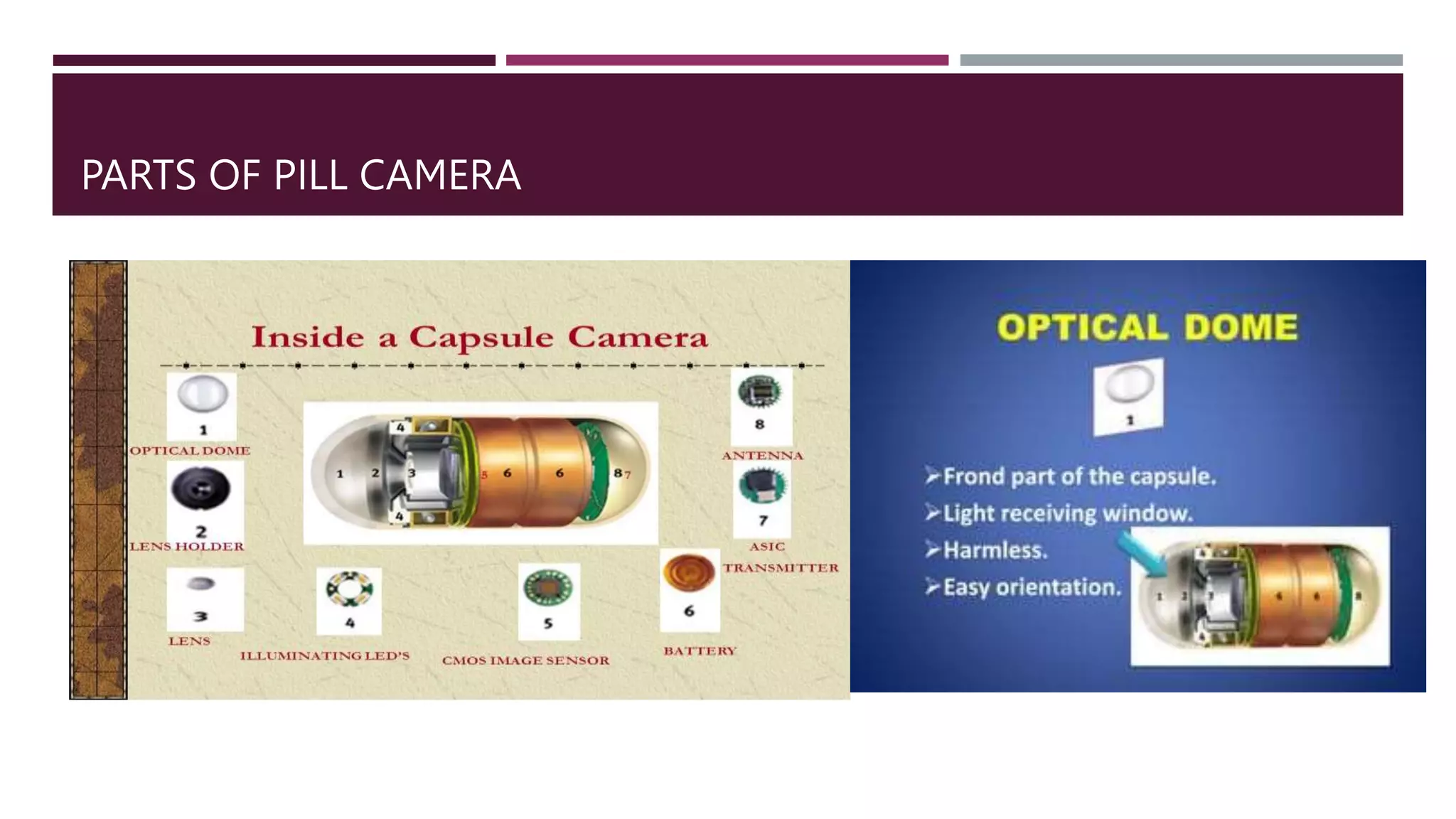 Pill camera.pptx | Digestive Disorders | Diseases and Conditions