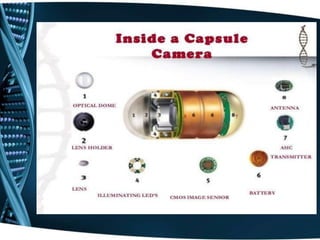 Pill camera | PPT