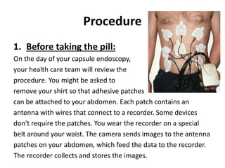 Pill camera | PPT