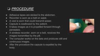 Pill camera in medicine | PPTX | Birth Control | Reproductive Health