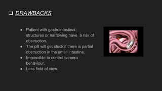 Pill camera in medicine | PPTX | Birth Control | Reproductive Health