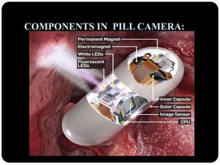Pill camera Technology | PPTX