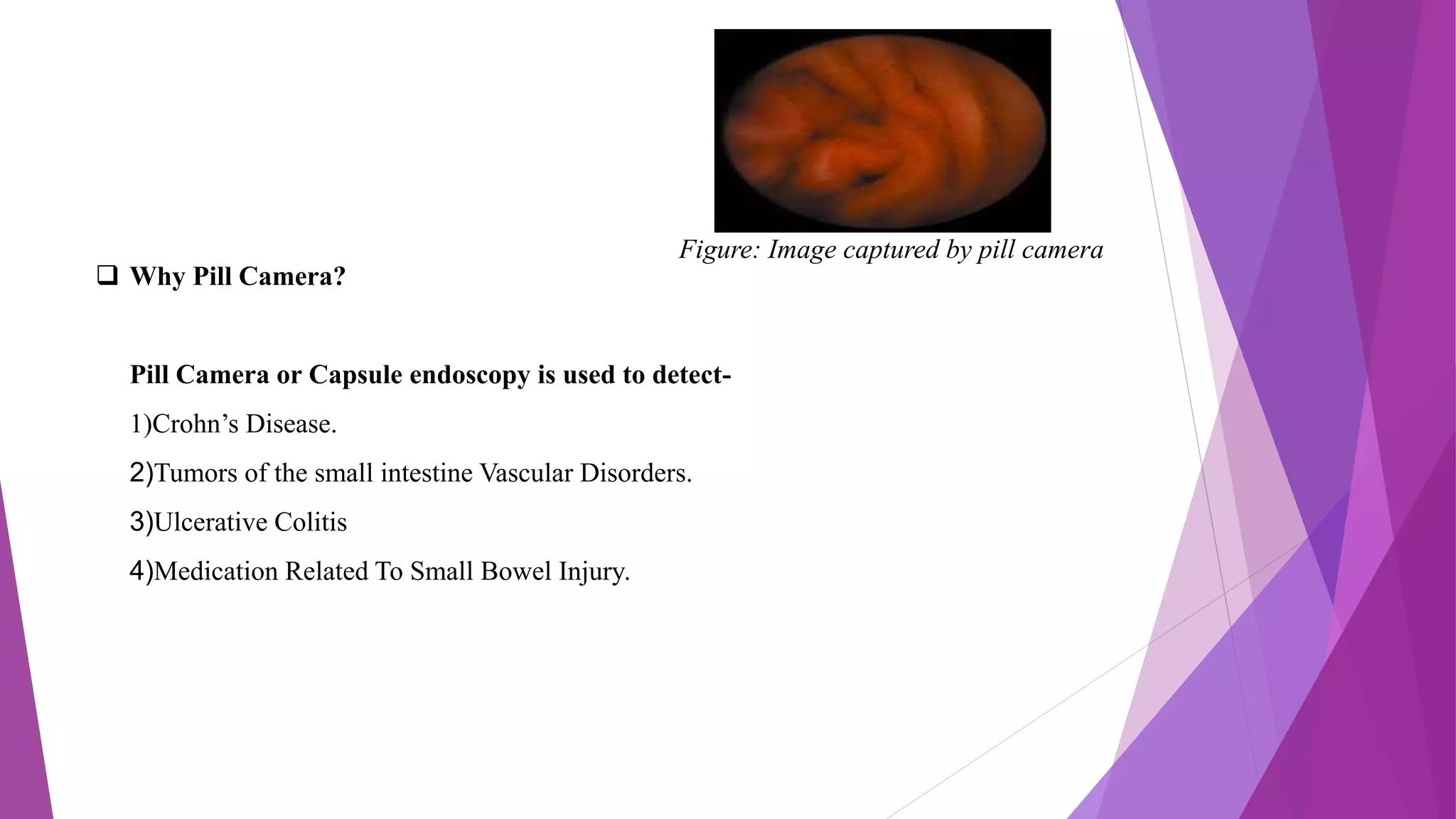 Pill camera(capsule endoscopy) | PPTX
