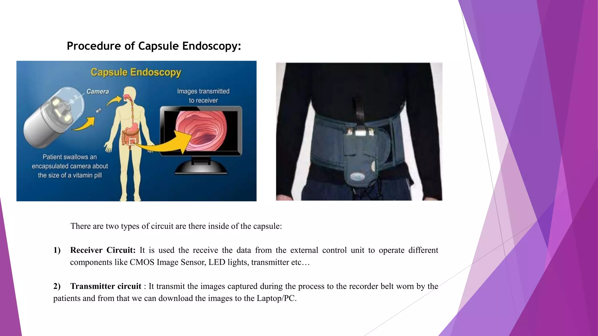 Pill camera(capsule endoscopy) | PPTX