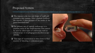 Pill Camera chandu.pptx