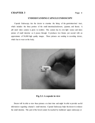 Pill camera documentation | DOCX