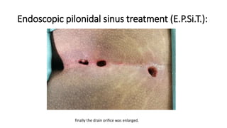 Pilonidal sinus disease | PPT