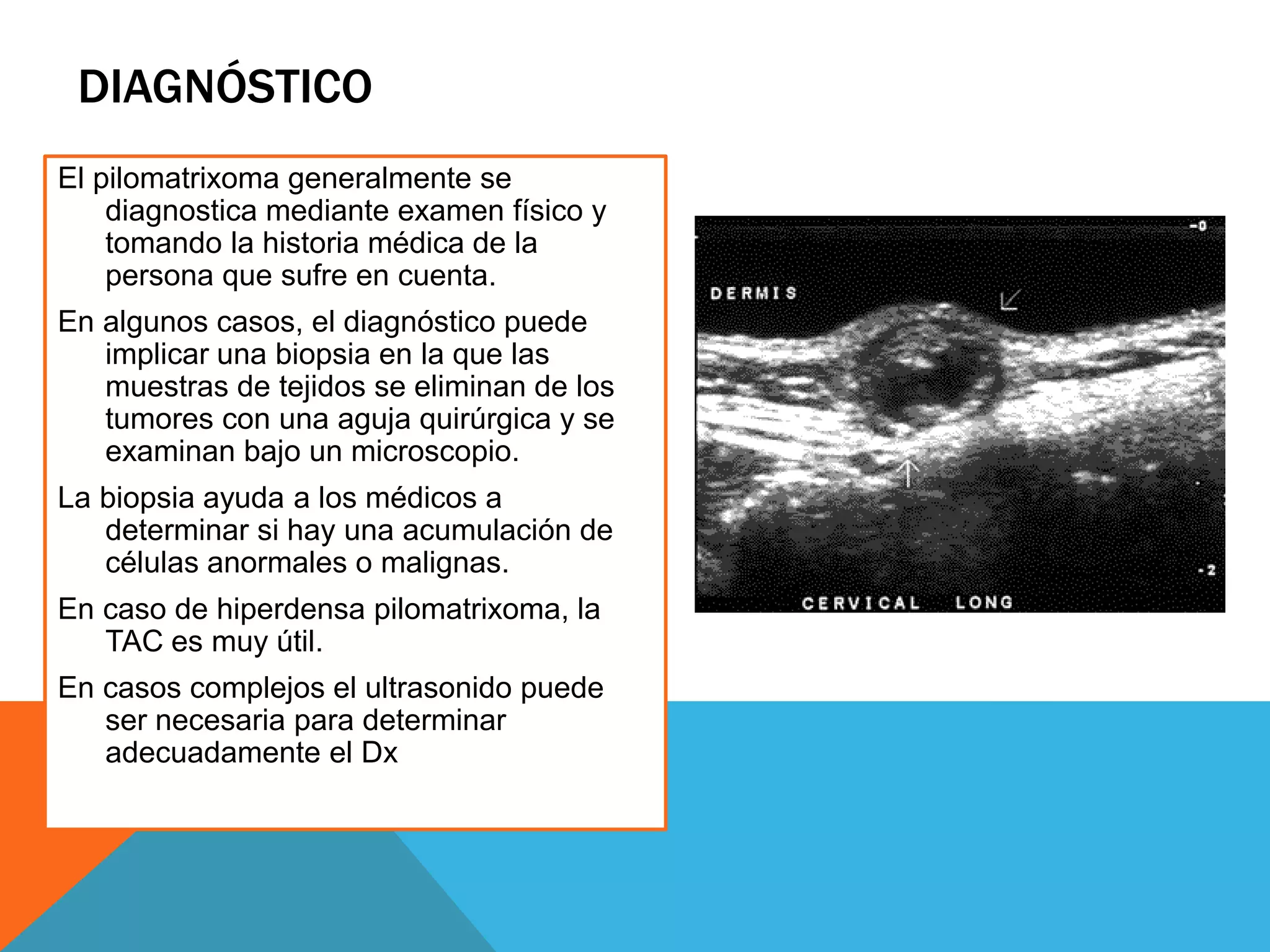 Pilomatrixoma | PPT