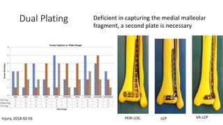 Ankle Fracture :Pilon Map Column Concept | PPTX