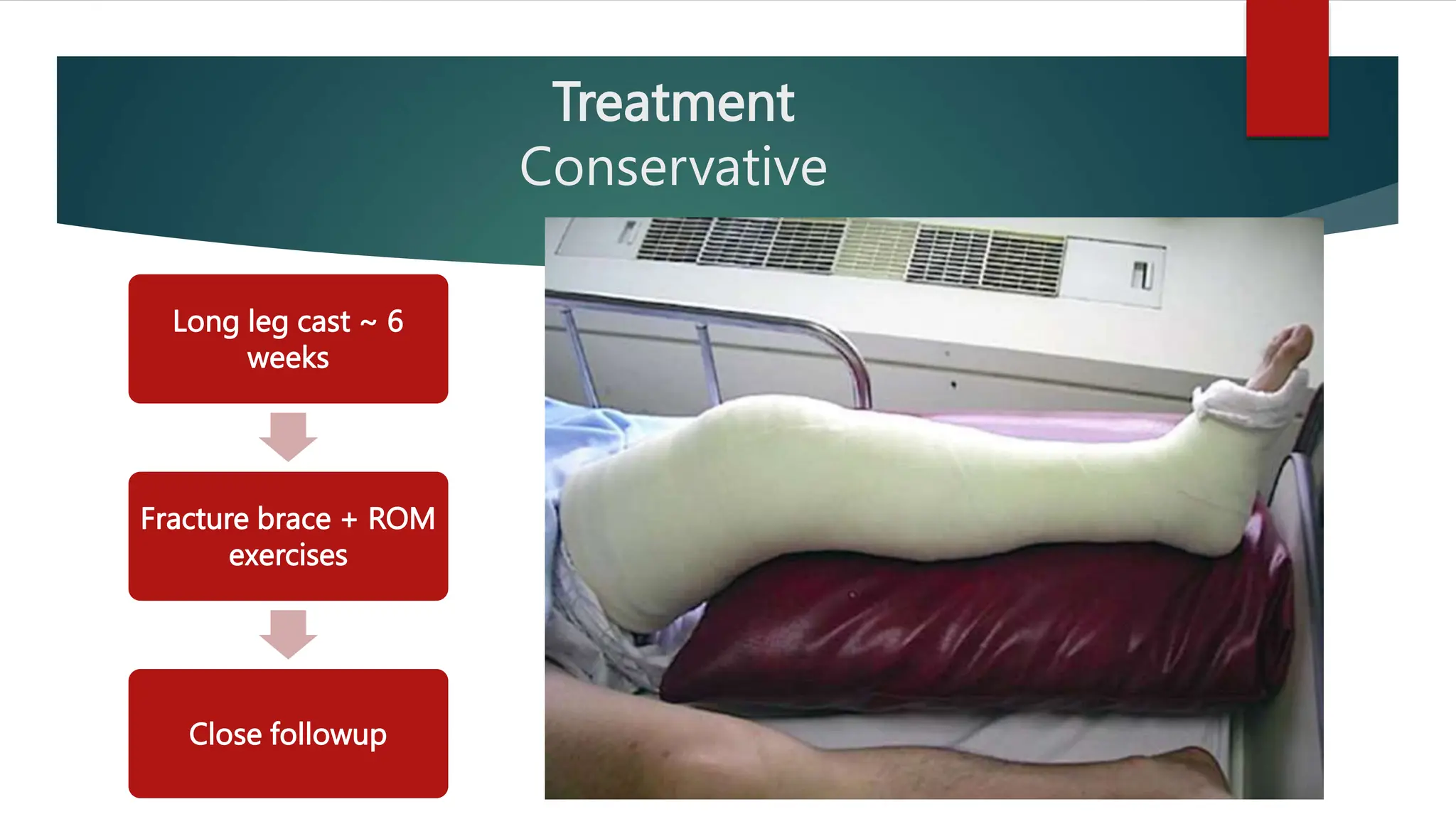 Diagnosis and Management of Tibial Plafond / Pilon Fracture.pptx