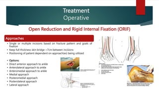 Diagnosis and Management of Tibial Plafond / Pilon Fracture.pptx
