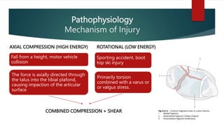 Diagnosis and Management of Tibial Plafond / Pilon Fracture.pptx