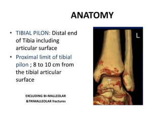 Pilon fracture | PPTX