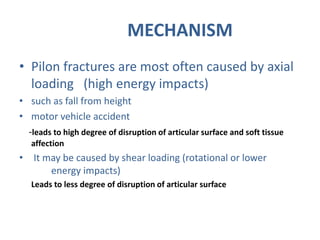 Pilon fracture | PPTX