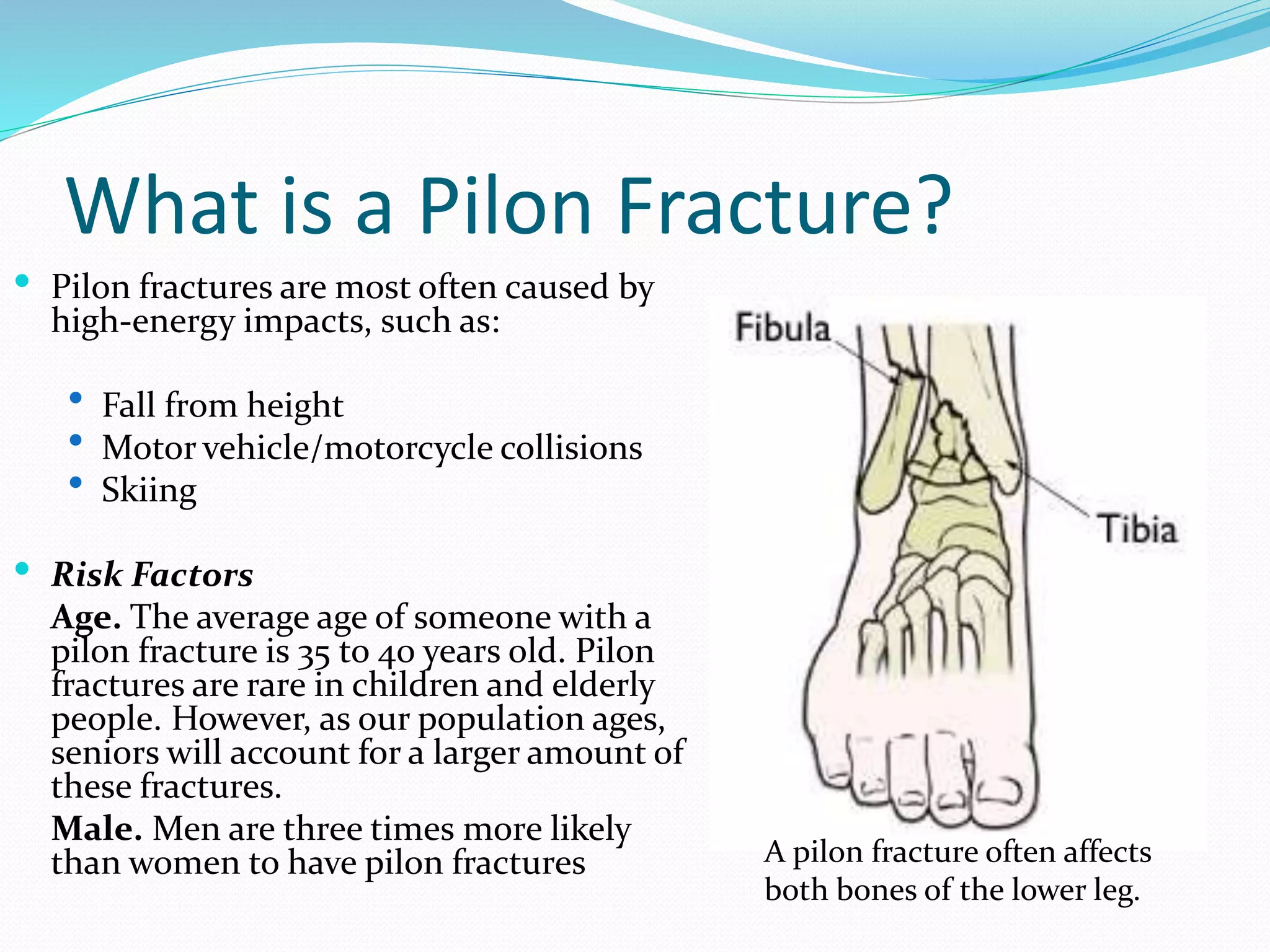 Pilon fractures | PPTX