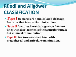 Pilon fractures | PPTX