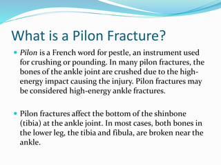 Pilon fractures | PPTX