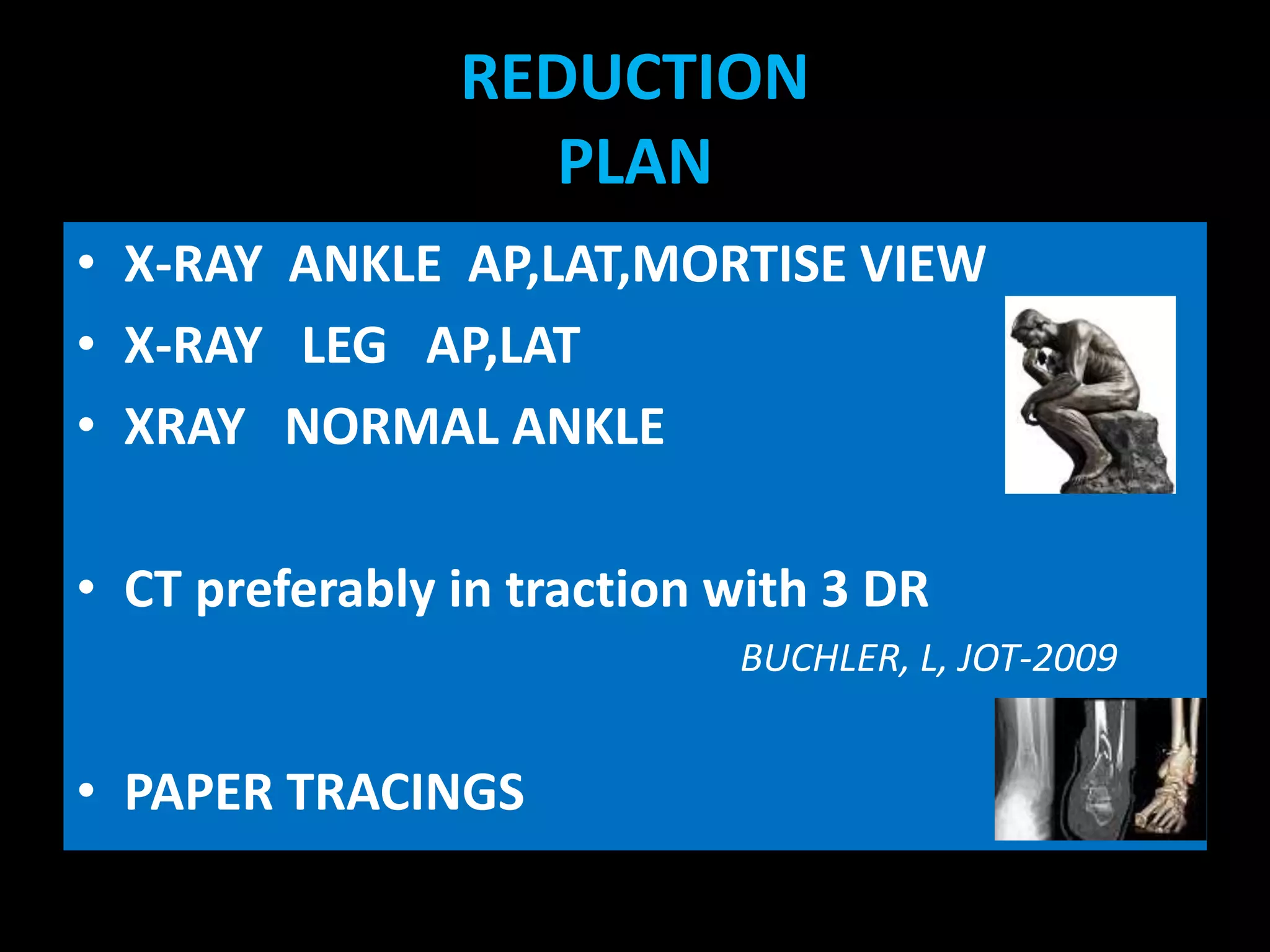 Pilon fractures reduction and fixation technics-dr mohamed ashraf-govt ...