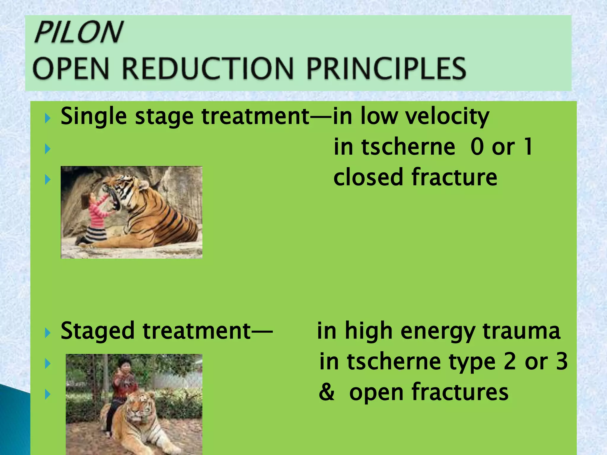 Pilon fractures reduction and fixation technics-dr mohamed ashraf-govt ...