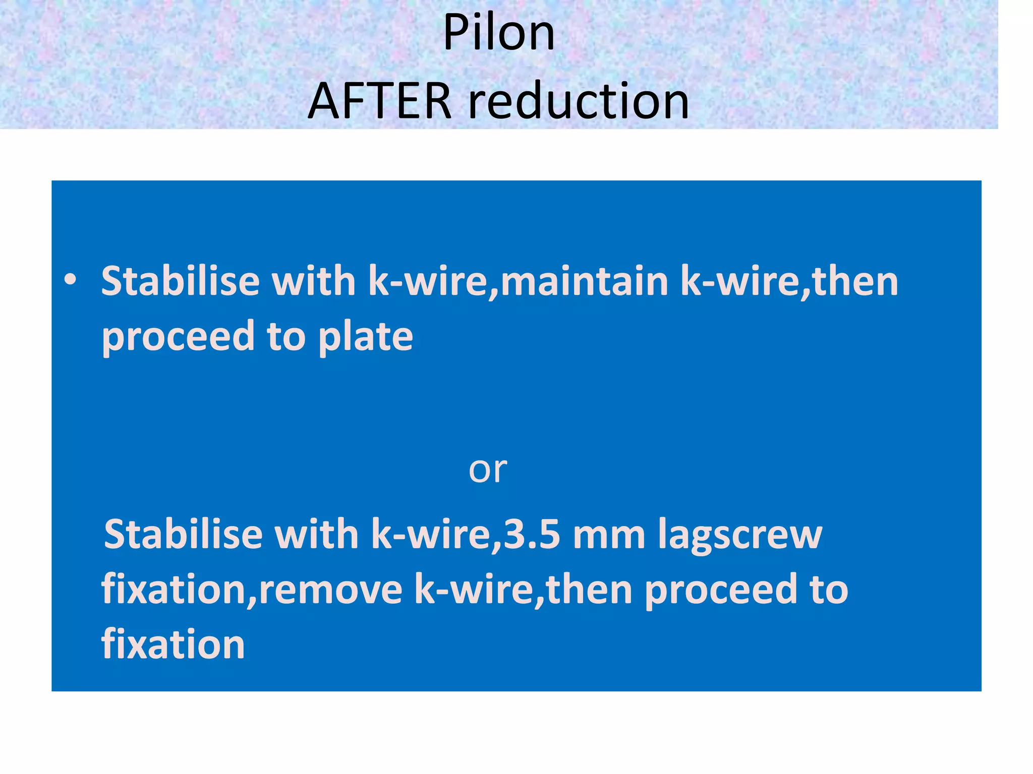 Pilon fractures reduction and fixation technics-dr mohamed ashraf-govt ...