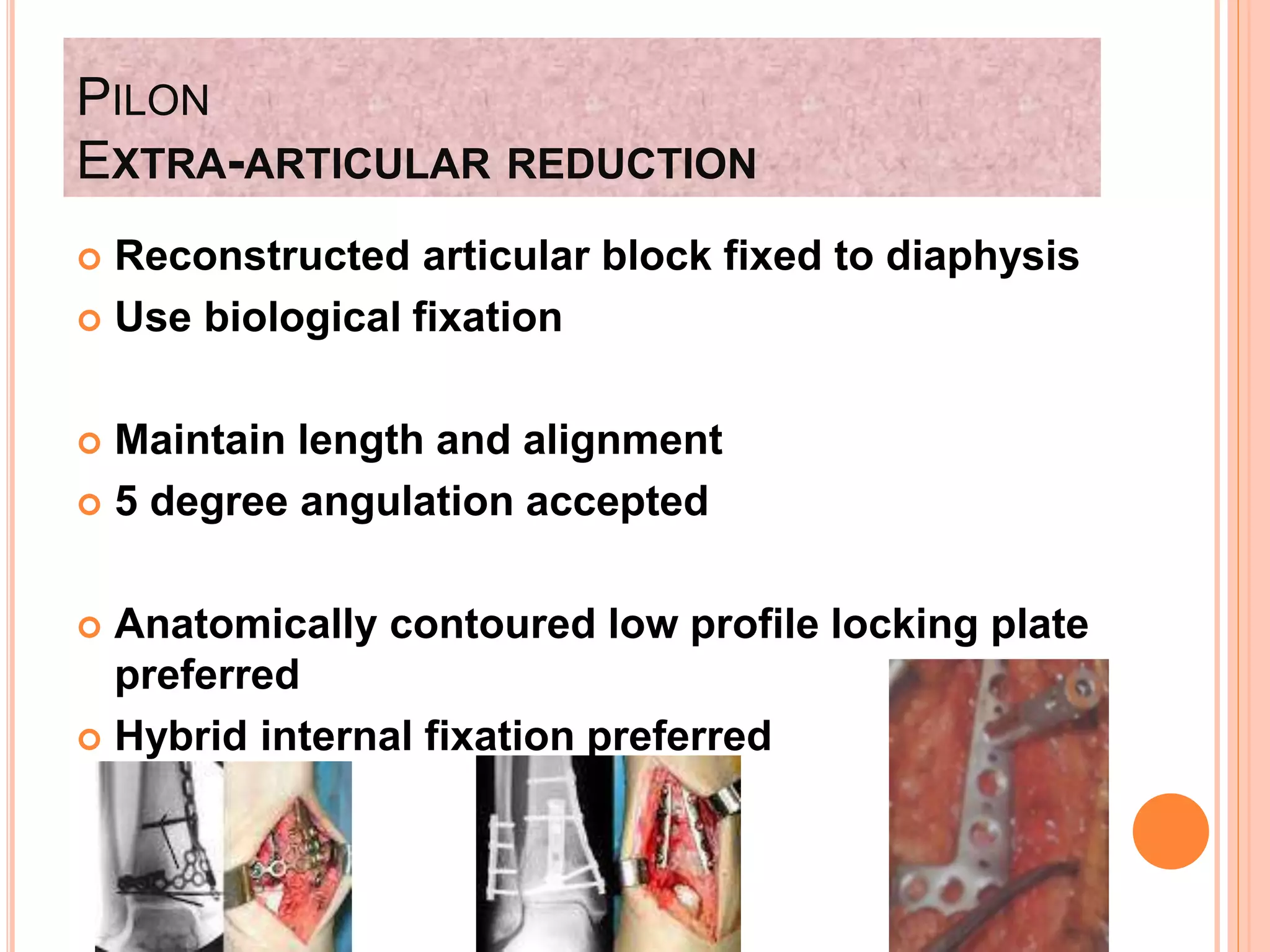 Pilon fractures reduction and fixation technics-dr mohamed ashraf-govt ...