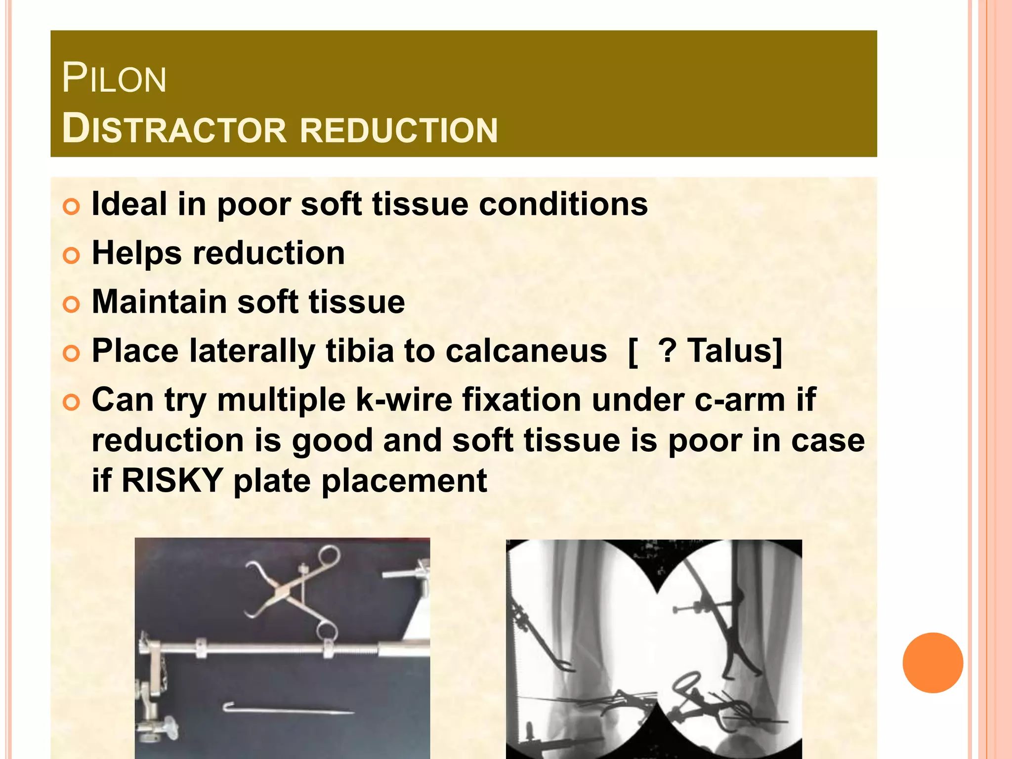 Pilon fractures reduction and fixation technics-dr mohamed ashraf-govt ...