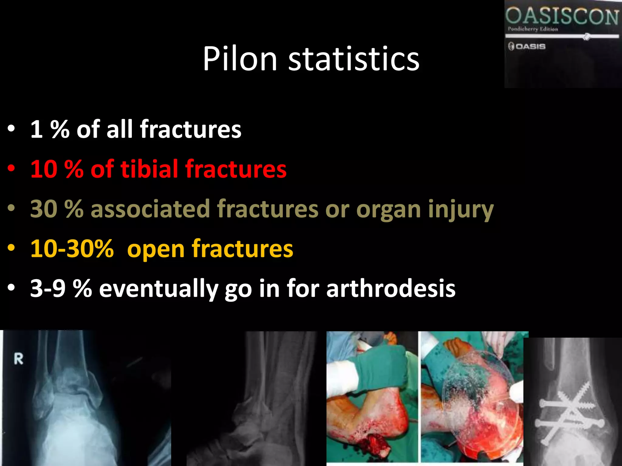 Pilon fractures reduction and fixation technics-dr mohamed ashraf-govt ...