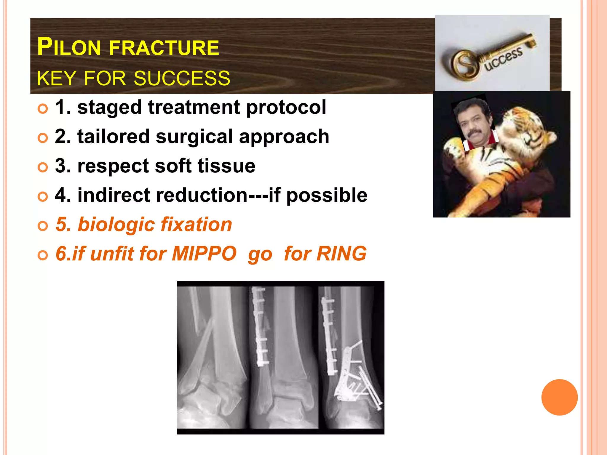 Pilon fractures reduction and fixation technics-dr mohamed ashraf-govt ...