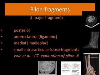 Pilon fractures reduction and fixation technics-dr mohamed ashraf-govt ...